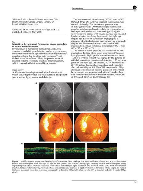 Pdf Intravitreal Bevacizumab For Macular Edema Secondary To Retinal Macroaneurysm