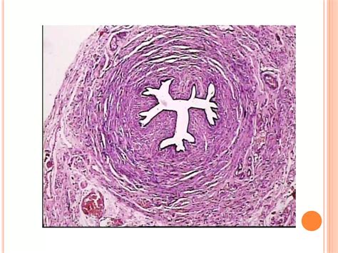 0102 Ambiguous Genitalia Case Presentationppt