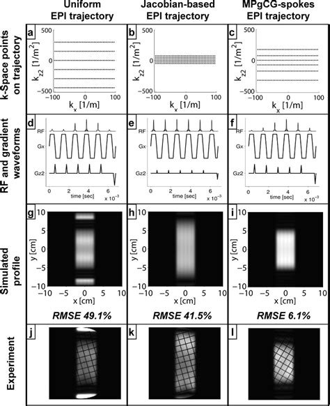 Radiofrequency Pulse Design Using Nonlinear Gradient Magnetic Fields Abstract Europe Pmc