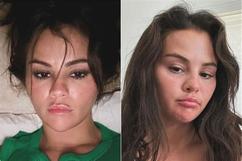 What Happened To Selena Gomez S Face Unveiling The Truth Rising Net