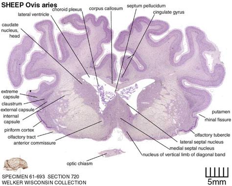 Atlas Of The Sheep Brain Section Image