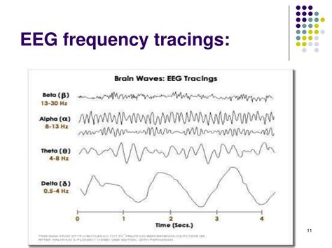 PPT EEG Biofeedback PowerPoint Presentation Free Download ID 26385
