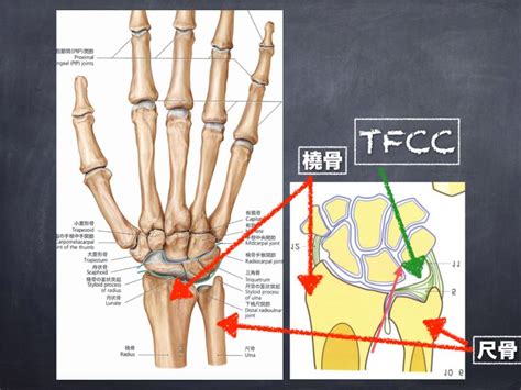Tfcc