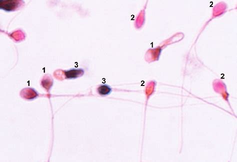 Different Patterns Of Sperm Stained By Triple Staining Method The Download Scientific Diagram