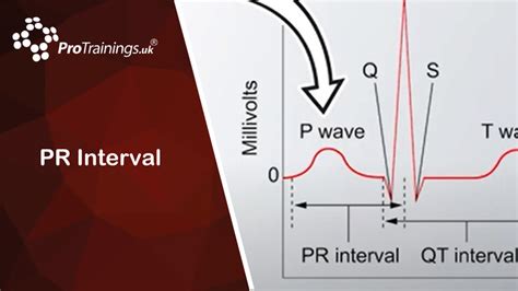 Pr Interval Ecg Awareness Online Training Video Ecg Awareness Level