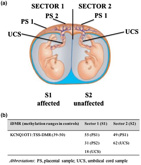 A Schematic Representation Of Placental And Umbilical Cord Download Scientific Diagram