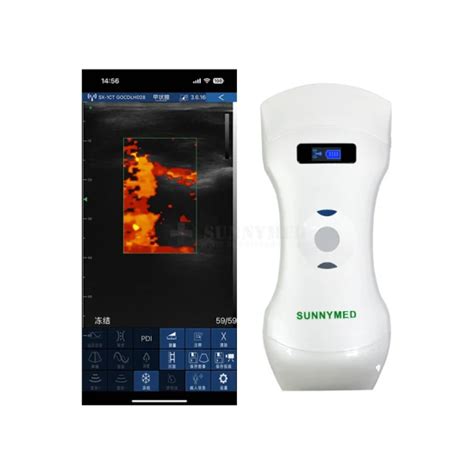 3 In 1 Wireless Cardiac Ultrasound Scanner Machine Convex Linear