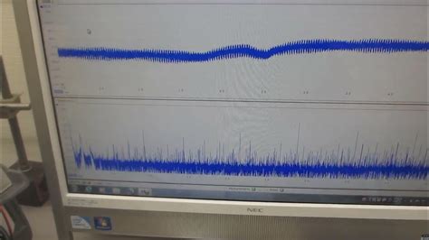 超音波プローブによる、スイープ発振システムーー低周波の共振現象と、高周波の非線形現象を発振制御する実験ーー（超音波システム研究所） Youtube