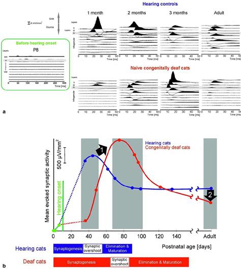 8 Functional Development Of The Auditory Cortex With And Without Download Scientific Diagram