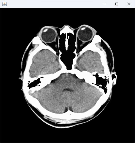 画像の表示 Kano Lab Docs