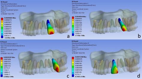 Directional Deformation In The Z Axis Extrusiveintrusive Movement In