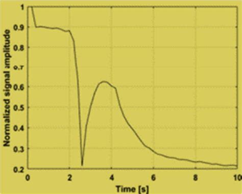 Figure 1 From Deep Learning Based Drowsiness Detection With Alert System Using Raspberry Pi Pico