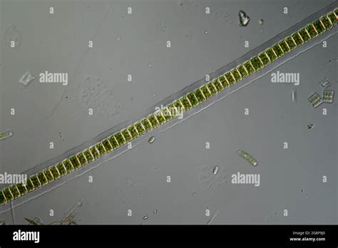 Green Algae Under The Microscope X Stock Photo Alamy