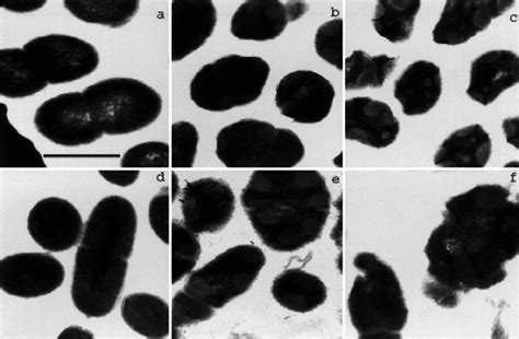 Transmission Electron Micrographs Of Non Pressure And Pressure Treated