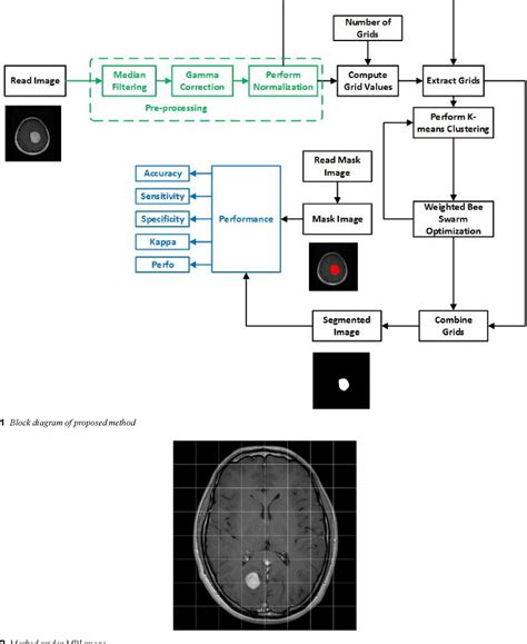 Figure 1 From Method Of Multi Region Tumour Segmentation In Brain Mri