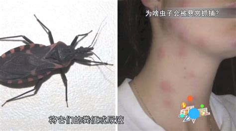 木虱王木虱梨木虱文秘苑图库