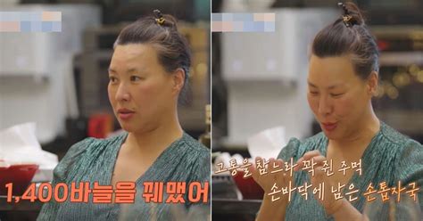 정영주 아들 교통사고 치아 13개 날아가고 2개 삼켜마취 없이 얼굴 1400 바늘 꿰맸다