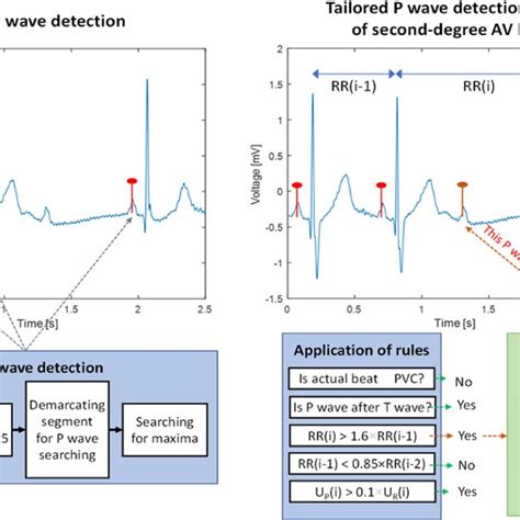 an example of the p wave detection procedure and the application of