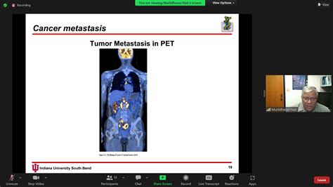 Hội Thảo Trực Tuyến Của Vian Công Nghệ Thông Tin Về “making Sense Of Complexities In Cancer