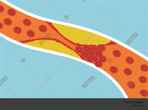Blood Circulation Vector And Photo Free Trial Bigstock Blood Circulation Vector And Photo Free Trial Bigstock