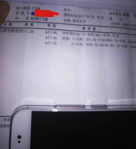 saoniuer 前天第一次尝试被多人内射啦羞羞哒虽然是安全期依然很担心今天拿到单子就松了口气以后还是带套套吧 Tumblr Pics saoniuer 前天第一次尝试被多人内射啦羞羞哒虽然是安全期依然很担心今天拿到单子就松了口气以后还是带套套吧 Tumblr Pics