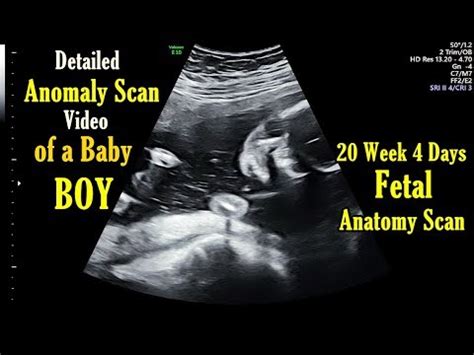 What Is An Anatomy Scan During Pregnancy