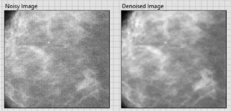 Noise Reduction From A Ct Image Using Haar Wavelet 76 Download