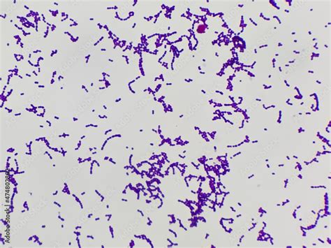 Streptococcus Pyogenes Infected In Aged Patient Showing Of Grams Stain From Positive