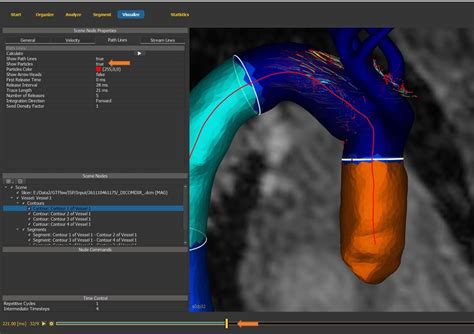4 Common Workflows — Gtflow 48x Documentation