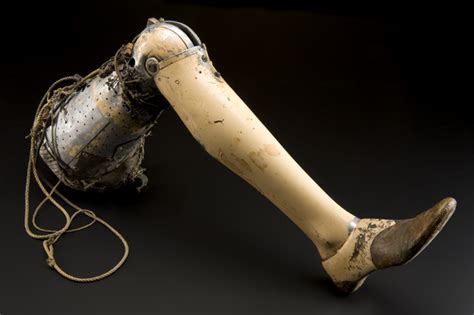 History Of Prosthetic Timeline Timetoast Timelines