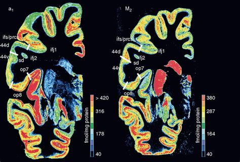 Cerebral Cortex Radiology Key Cerebral Cortex Radiology Key