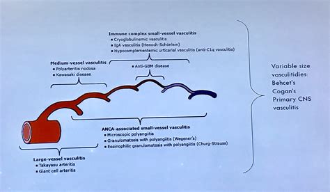 Vasculitis Symptoms