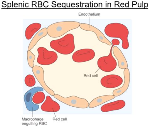 Pathii 1 Lecture 1 Hemolytic Anemias Flashcards Quizlet