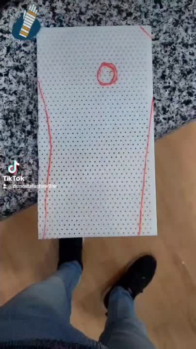 Video Mcp Flexion Splint For Wrist Joint Mostafa Shawky Pt Msc Phd Candidate Posted On