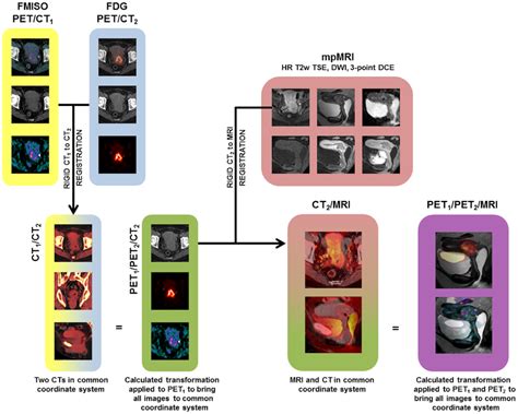 Step By Step Illustration Of The Rigid Registration Download