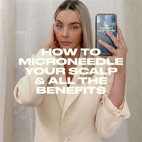 How To Microneedle Your Scalp And All The Benefits The Skinny Confidential