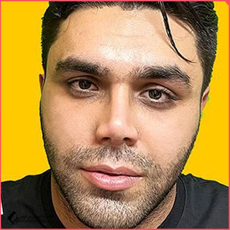 المواصفات والسعر وحجز موعد تجميل الأنف الدكتور كامران خدا كرمي