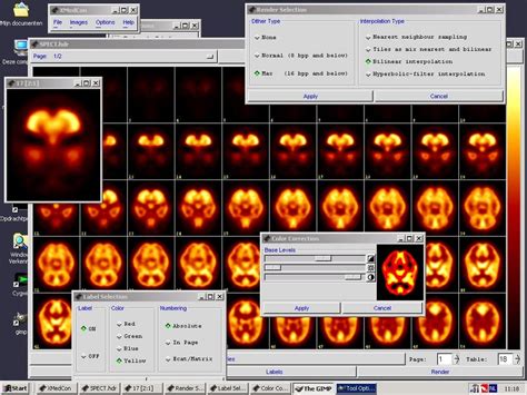 Top Open Source Free DICOM Viewers For Medical Professionals