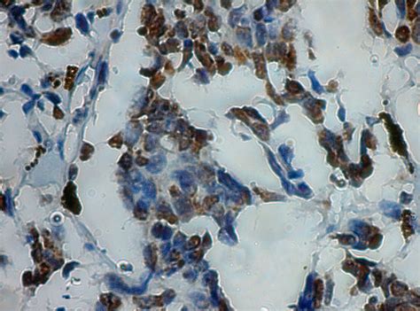 Hsa Mir 29b Probe Biogenex