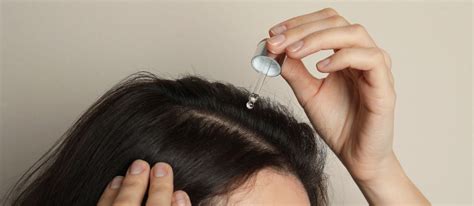 Домашно лечение на косопад Сложи край на проблема