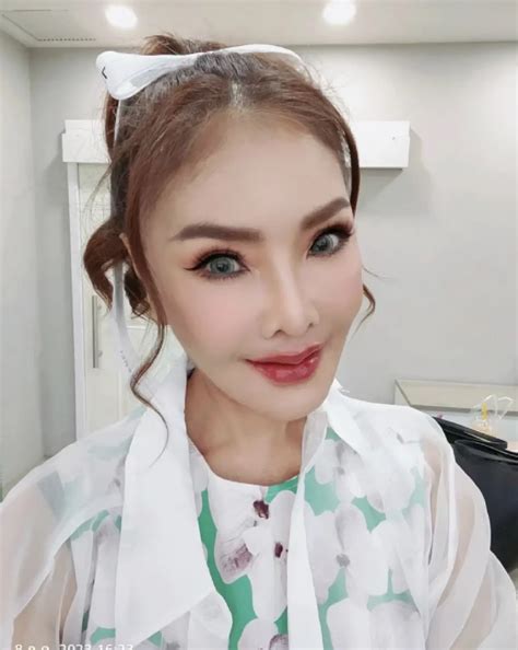 อัปเดตหน้าล่าสุด ดาว มยุรี หลังศัลยกรรมดึงหน้า ครบ 3 เดือน สวยตึงกว่าเดิม คมชัดลึก