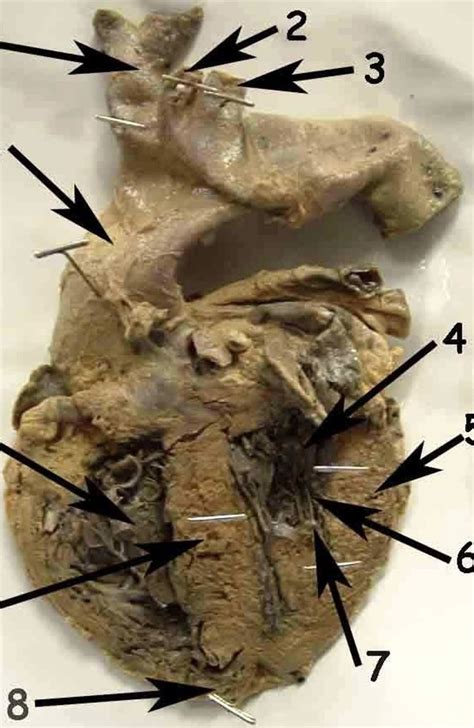 Heart Longitudinal Section Diagram Quizlet
