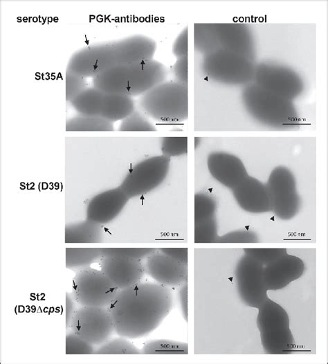 Transmission Electron Microscopic Localisation Of Pneumococcal Pgk