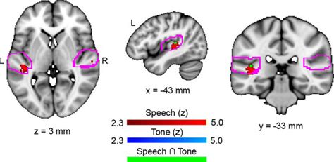 Areas Within The Auditory Cortex That Are Sensitive To Onset Latency