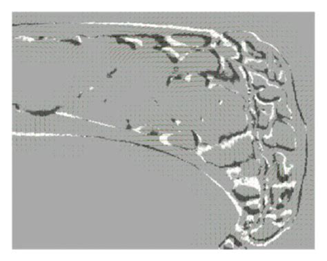 Comparison Of The Results Achieved By Segreg And Intensity Based Download Scientific Diagram