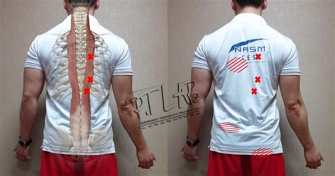 척추기립근part1 최장근 Longissimus 기능해부학 편 양재동 퍼스널트레이닝 피티랩 네이버 블로그