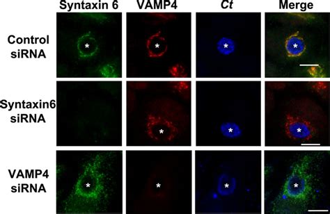 Vesicle Associated Membrane Protein 4 And Syntaxin 6 Interactions At