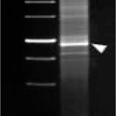 Ds Cdna Produced From Polya Placenta Rna Using Smart Protocol