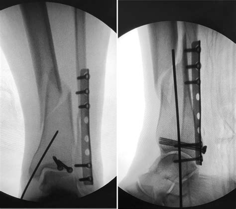 The “double Midpoint Double Axis” Approach Of Rtn In Clinical Download Scientific Diagram