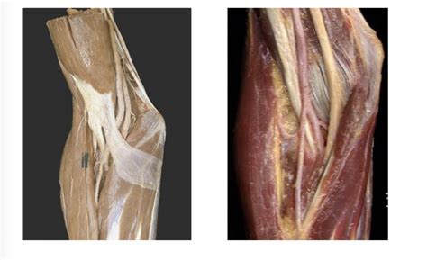 Diagram Of Cubital Fossa Cadaver Quizlet